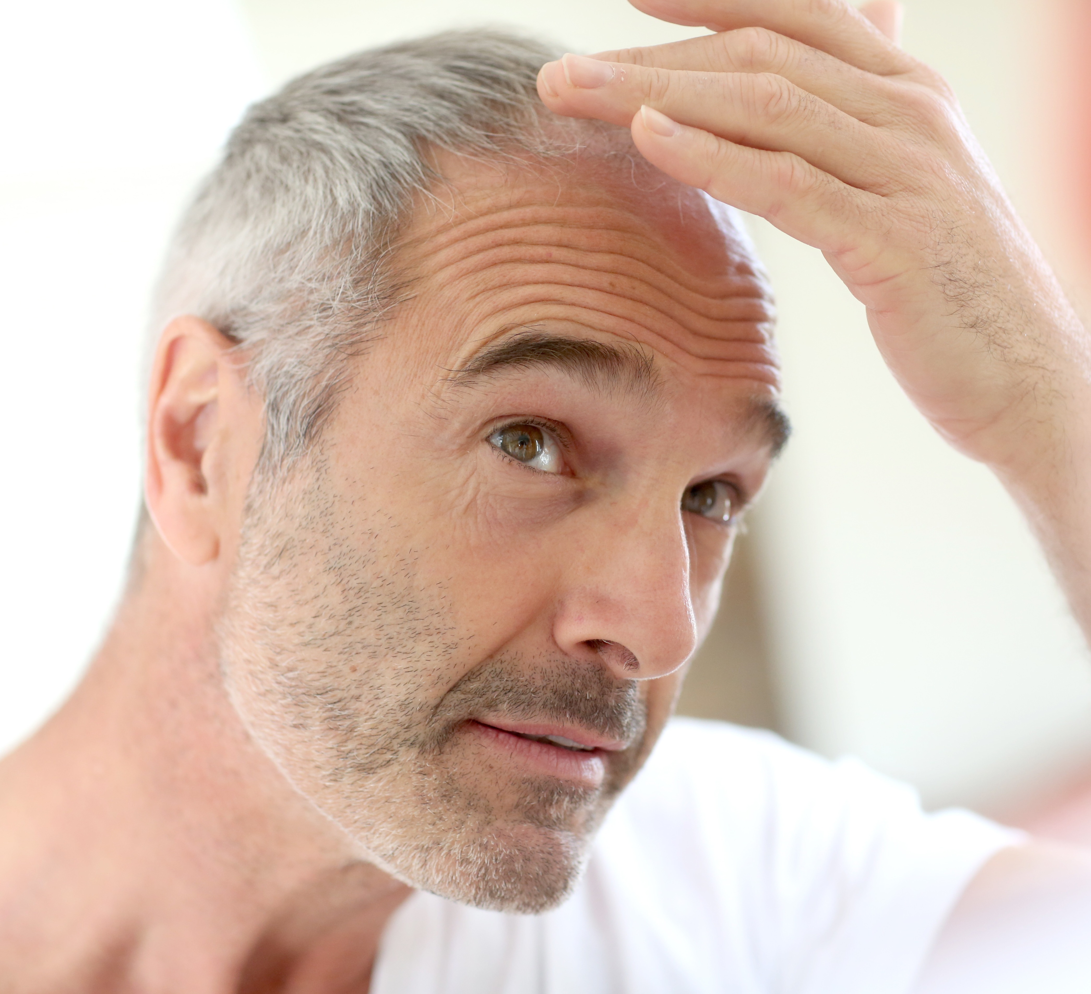 Hair Thinning & Hair Loss